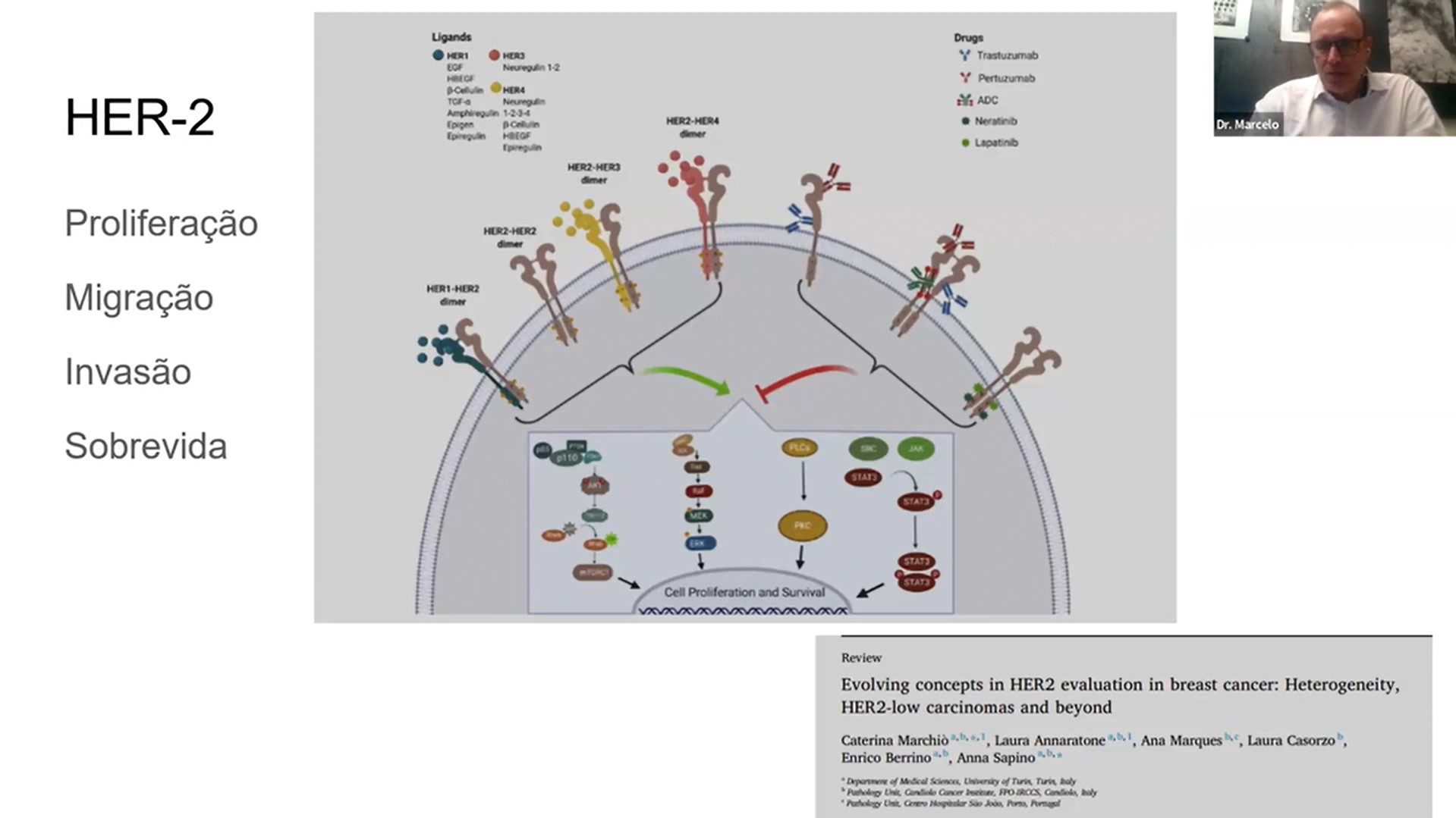 [SBM] Carcinoma Lobular Invasivo HER2+ | makadu.live - 2023