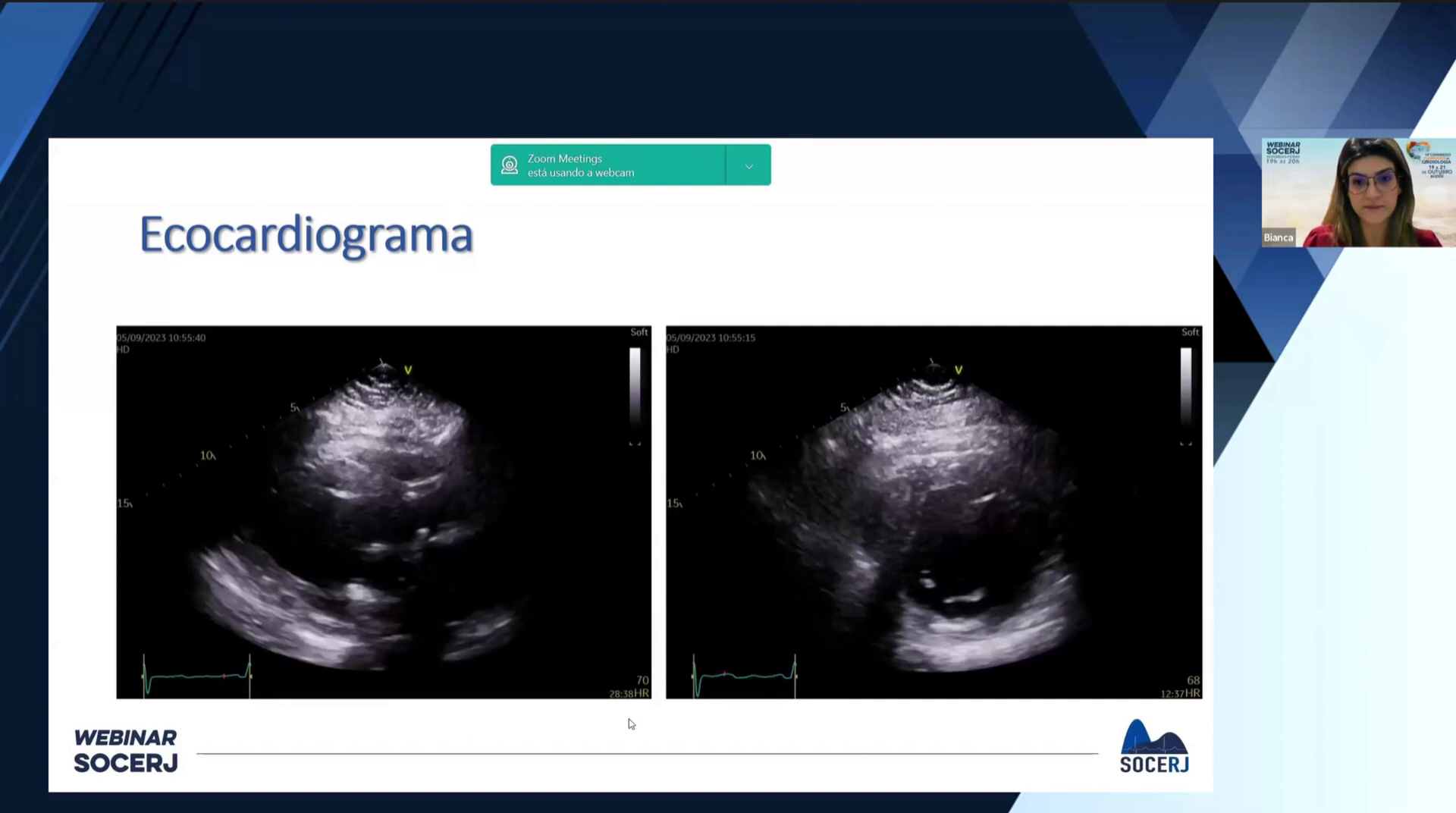 [SOCERJ] Ecocardiograma | makadu.live - 2023