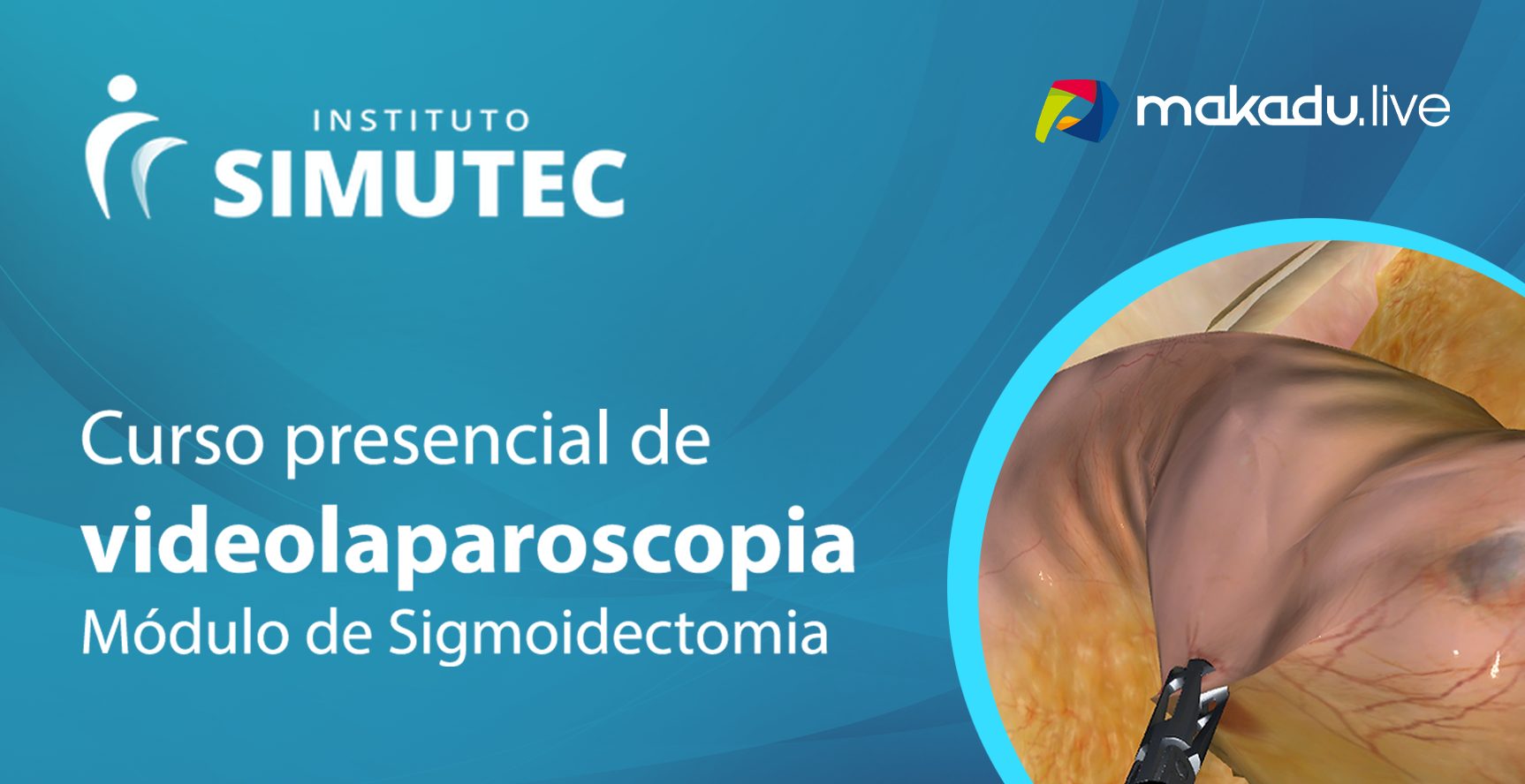 Curso Presencial de Videolaparoscopia - Sigmoidectomia