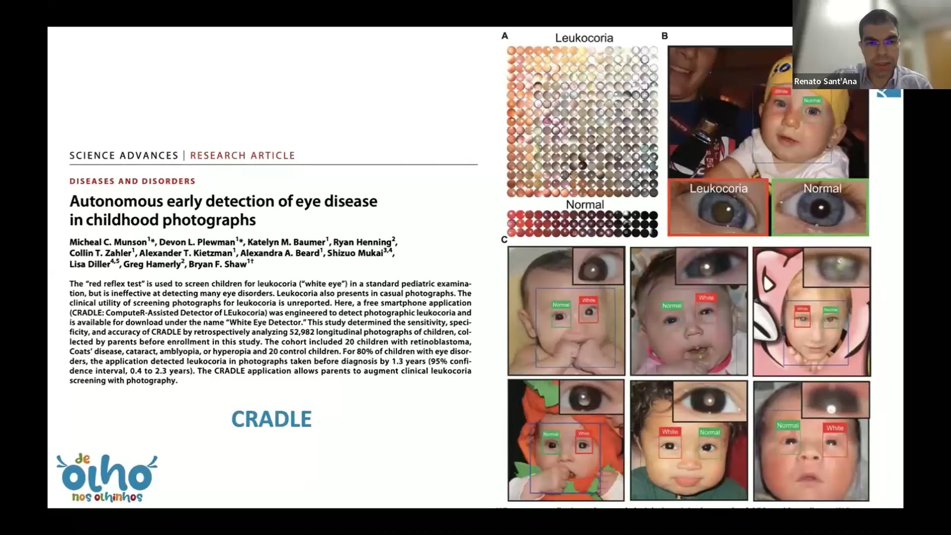 [FiNorte] Retinoblastoma: Diagnóstico e Tratamento | makadu.live - 2024